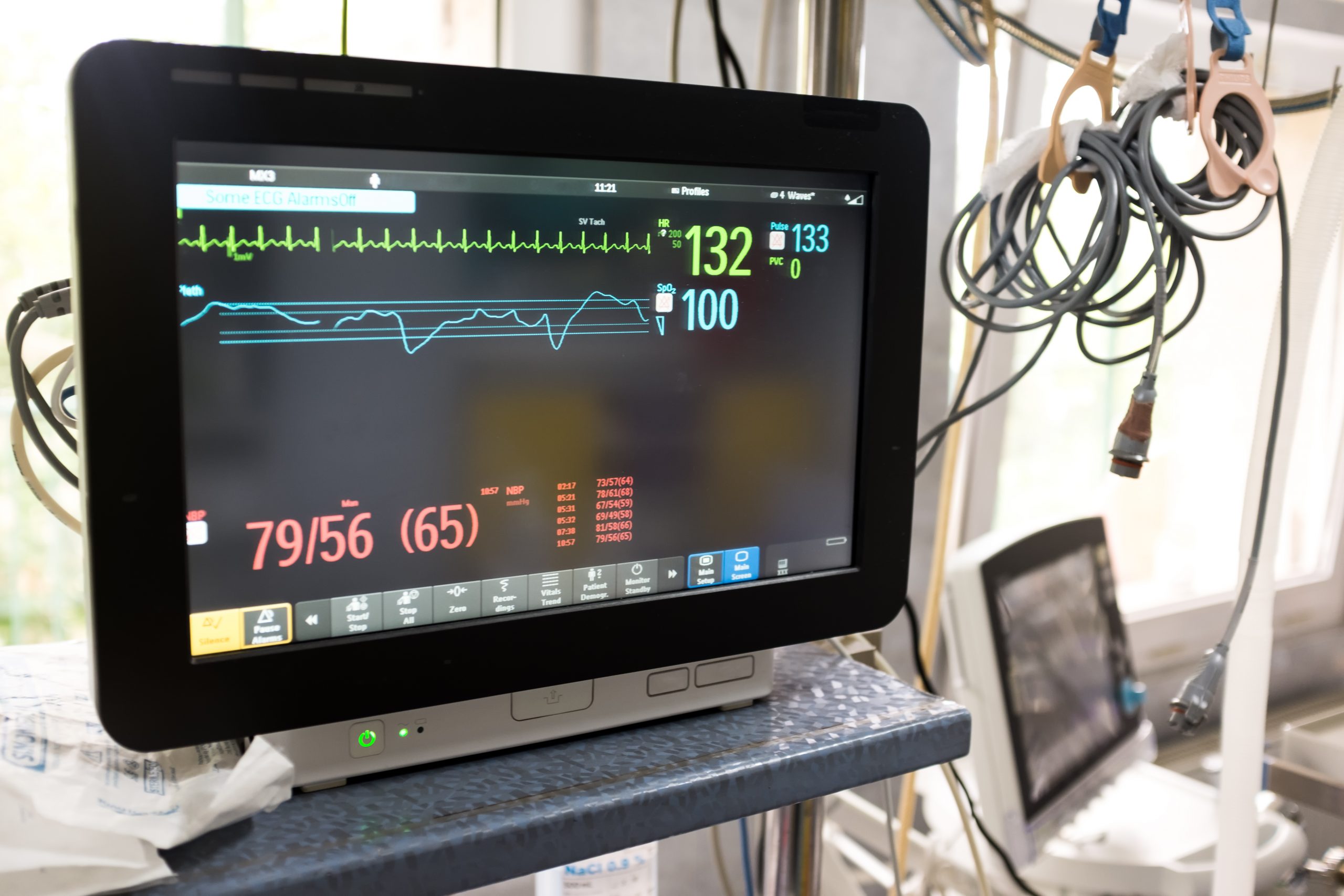ECG-Digital Electrocardiograph - Kalstein